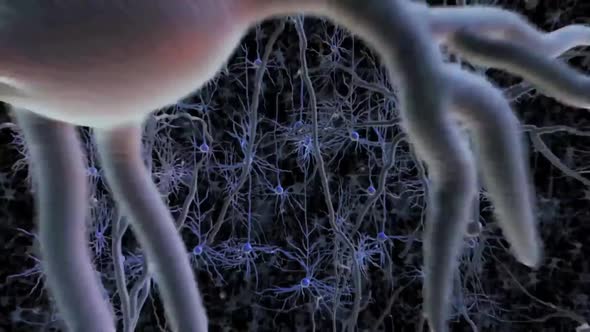 Neurons With Amyloid Plaques, Animation, Motion Graphics | VideoHive