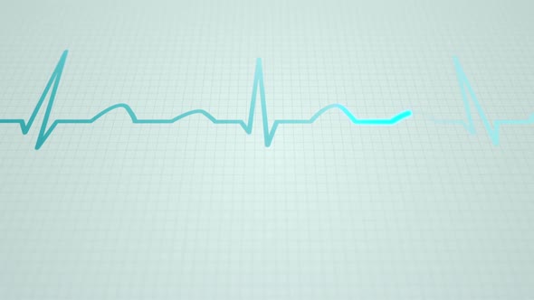 Animation of a schematic diagram of normal sinus rhythm for a human ...