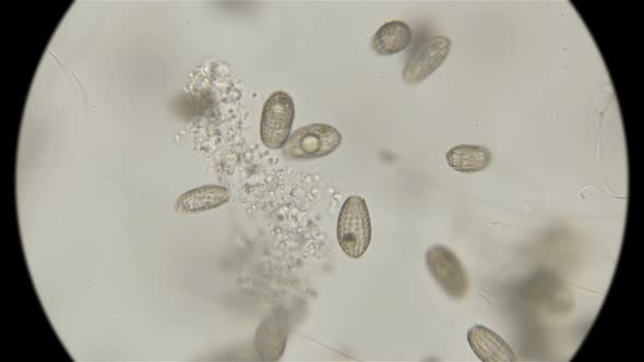 a Large Colony of Ciliates Coleps, Which Are Largely Located in Dirty ...