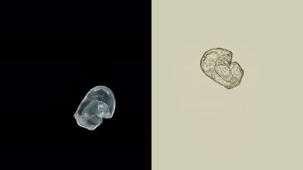 The Larva of the Starfish Asteroidea, Under the Microscope, Is in the ...