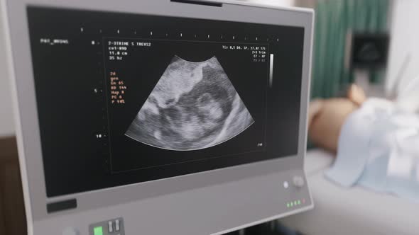 Prenatal scan procedure shows the stable condition of unborn babies at ...