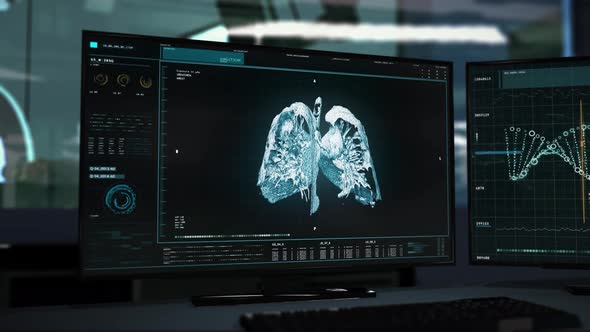 High Tech Cancer Treatment Medical Software Interface Scanning Human ...