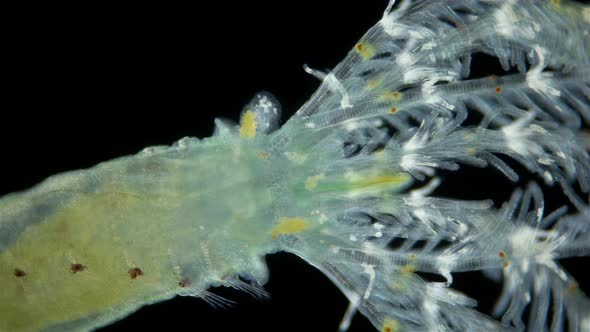 Polychaeta worm, family Sabellidae under a microscope, Stock Footage