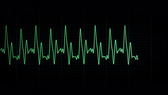 Heart Rate Monitor, Motion Graphics | VideoHive