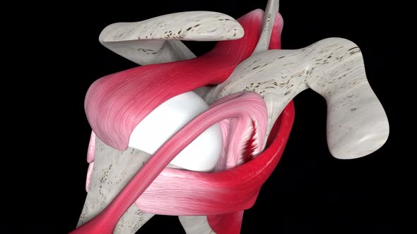 Shoulder Labral Tear Repair, Motion Graphics | VideoHive