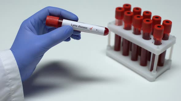 Negative Lyme Disease Test, Doctor Showing Blood Sample in Tube, Health ...