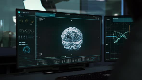 Brain Scan Analyzed In Advanced Medical Software At Neurosurgery ...
