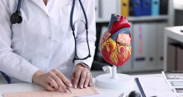 Cardiologist Examines Electrocardiogram of Patient with Heart Disease ...