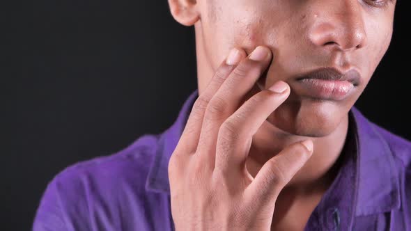 Close Up of Young Man Face with Skin Problem, Stock Footage | VideoHive