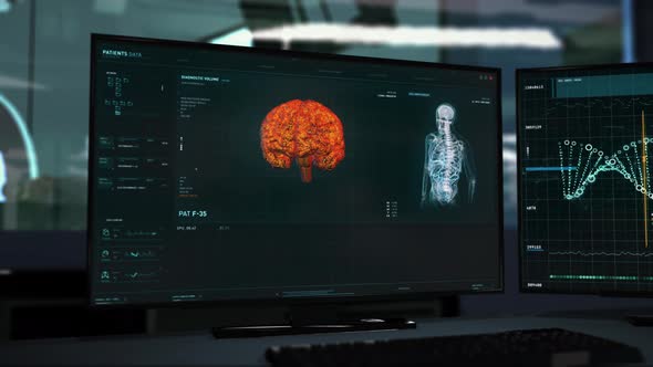 Medical Biology Scanner Displays On Screen Data Of Patients Brain ...