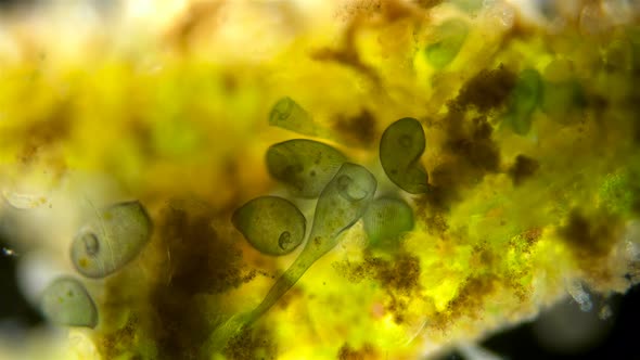 Colony Infusoria Stentor Under the Microscope, the Family Stentoridae ...