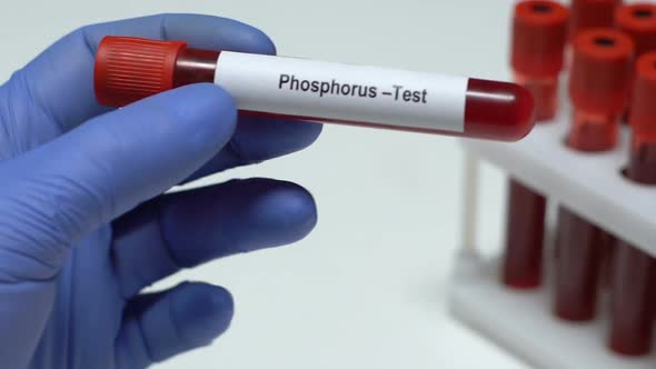 Phosphorus-Test, Doctor Holding Blood Sample in Tube Close-Up, Health ...