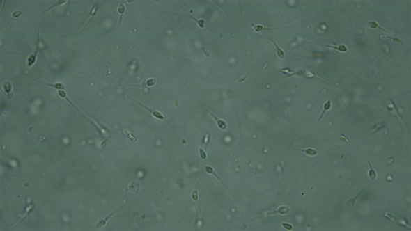 Sperm Under the Microscope, the Movement of Sperm Cells in the Seminal ...