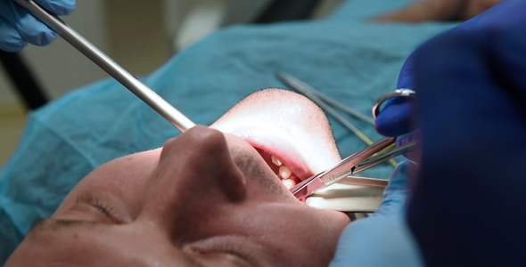Dentist Scissors Cuts The Thread, Stock Footage | VideoHive
