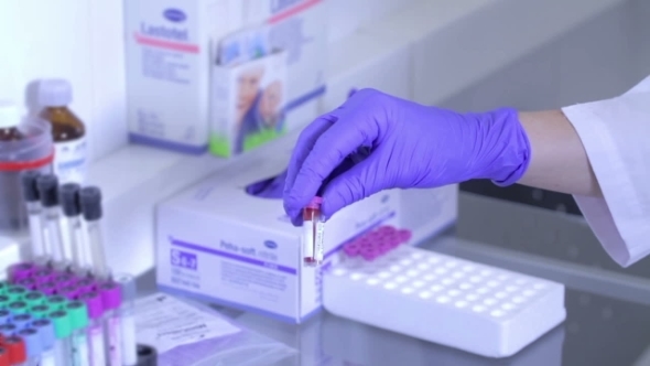 Nurse Shaking Blood In Test Tubes, Stock Footage | VideoHive