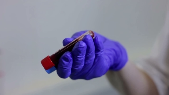 Nurse Shaking Blood In Red Test Tube, Stock Footage | VideoHive