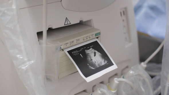 Dr. Prints Picture. Ultrasonic And Work With It, Stock Footage | VideoHive