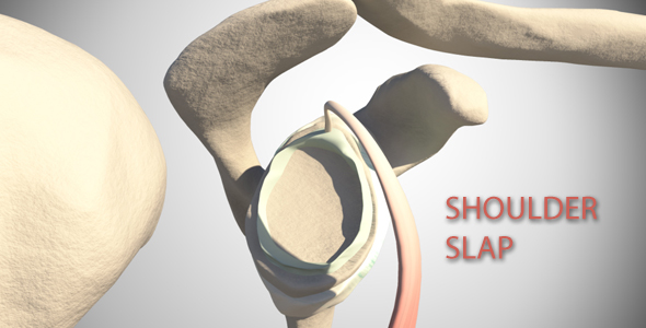 Shoulder Slap, Motion Graphics | VideoHive