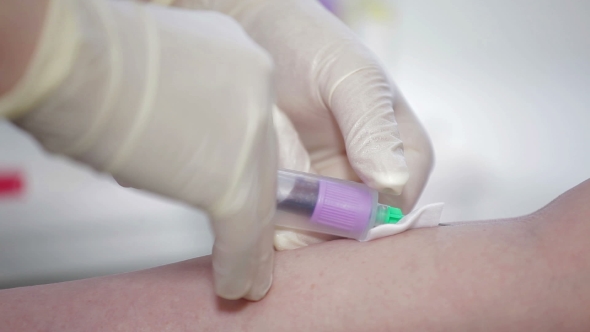 Blood Test In Modern Medical Laboratory, Stock Footage | VideoHive