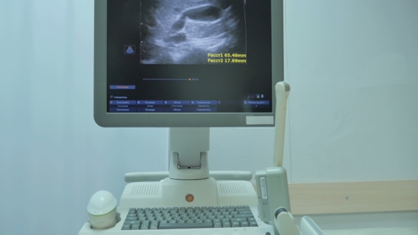 Ultrasound Scanner, Stock Footage | VideoHive