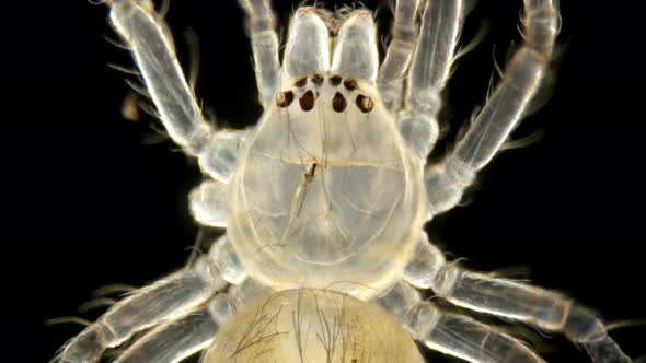 Spider Under a Microscope, Arachnida Class, Arthropoda Squad, Stock Footage