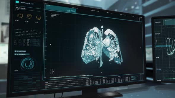 Advanced Medical Software System Ui Conducts Disease Analysis Diagnosis ...