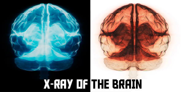 Cool X-ray of the Brain, Motion Graphics | VideoHive