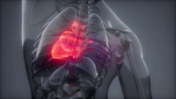 Human Heart Radiology Exam, Motion Graphics | VideoHive