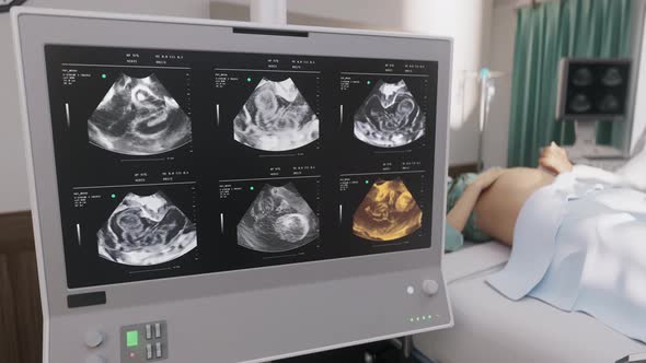 Using Modern Ultrasound Scanner For Prenatal Health Care Diagnostic ...