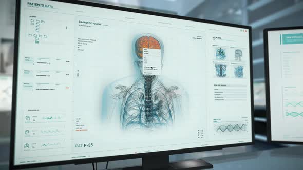 Diagnostic Medical Scanning Device During Laboratory Radiology Analysis ...