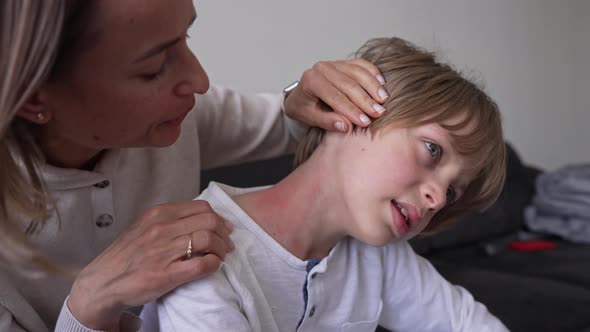 Symptoms of Photodermatitis, Stock Footage | VideoHive