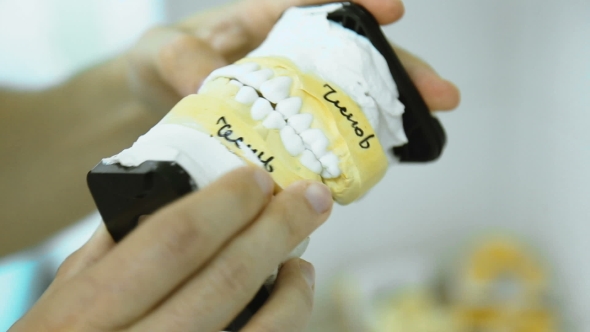 Casts Of Dentures. Manufacture Of Dentures, Stock Footage | VideoHive