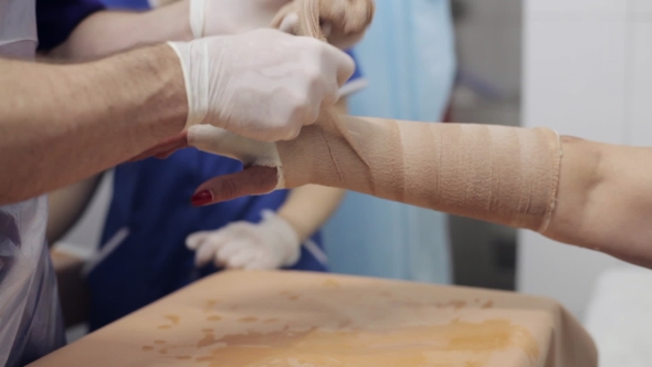 Doctor Lay On Gypsum On The Hand Female Patient, Stock Footage | VideoHive