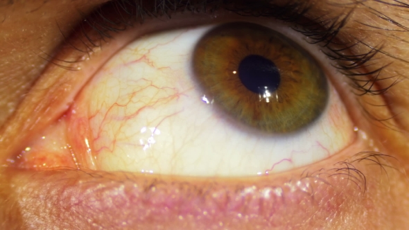 Eye Rotation Of The Eyeball, Stock Footage | VideoHive