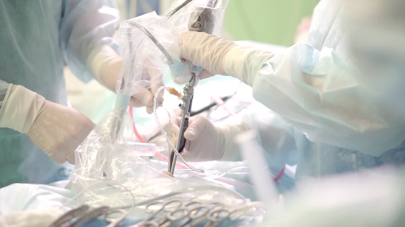Doctor Performs Endoscopic Surgery Removing a Brain Tumor., Stock Footage