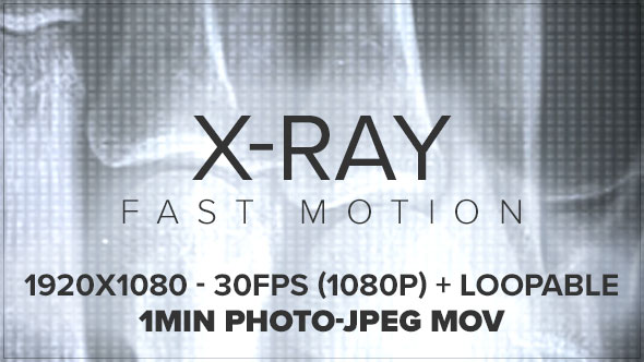 X-Ray : Fast Motion , Motion Graphics | VideoHive