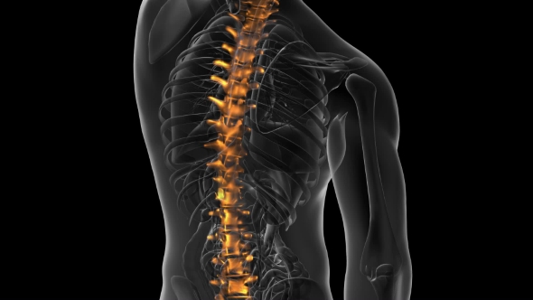 Backache in Back Bones, Motion Graphics | VideoHive
