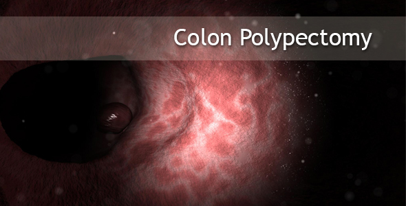 Colon Polypectomy, Motion Graphics | VideoHive