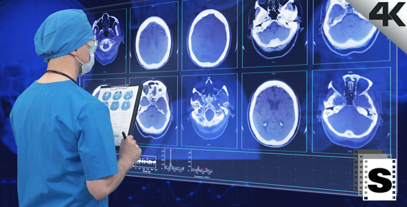 Mri On Screen, Stock Footage | VideoHive