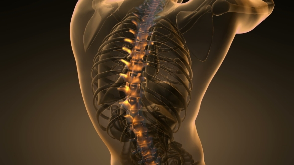 Backache in Back Bones, Motion Graphics | VideoHive