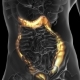 Anatomy Scan of Human Colon, Motion Graphics | VideoHive