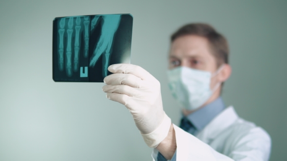 the Doctor Works in the Hospital Looks X-ray, Stock Footage | VideoHive