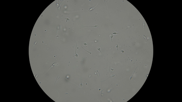 the Movement of the Sperm Under a Microscope, Stock Footage | VideoHive