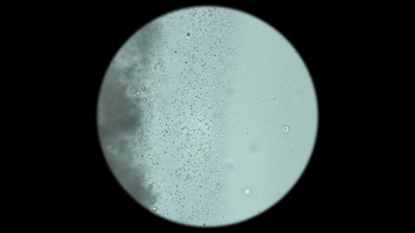 a Large Colony of Protozoa Moves Under a Microscope, Stock Footage