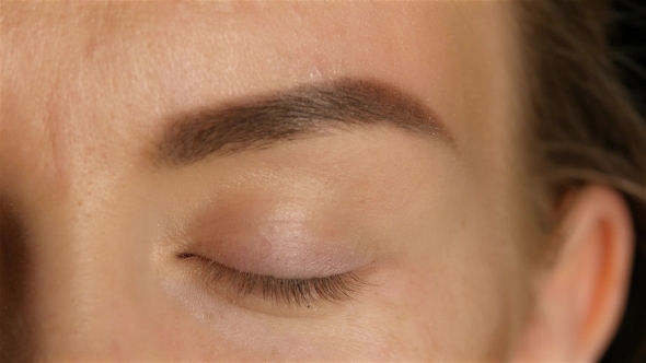 Girl Opens Her Eyes and Her Eyes Are Very Sore and Swollen, Stock Footage