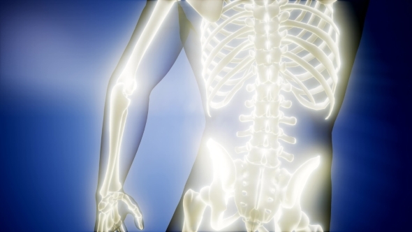 Human Bones Radiographic Scan, Motion Graphics | VideoHive