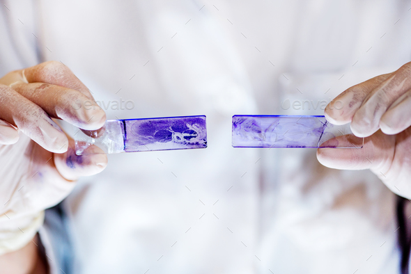 Microbiology laboratory work, comparing results Stock Photo by microgen