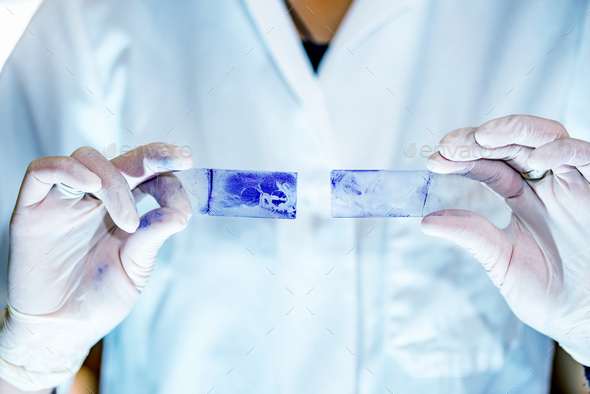 Microbiology laboratory work, comparing results Stock Photo by microgen
