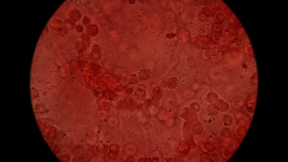 Menstrual Blood with Its Microflora and Bacteria Under Microscope ...