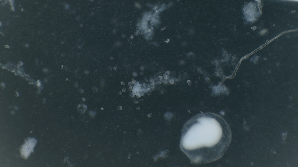 Large Colony of Protozoa Moves Under a Microscope, Stock Footage ...